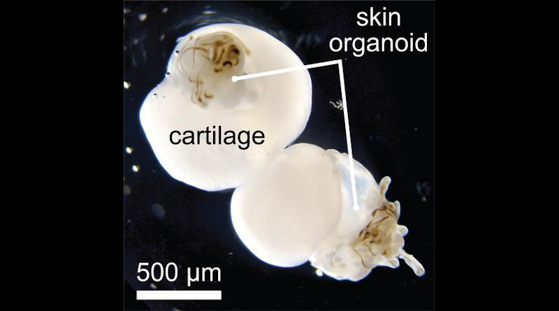 Hairy, Lab-Grown Human Skin Cell Model Could Advance Hair Loss Research ...