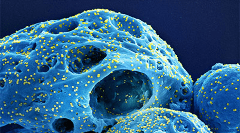 Why Subvariants Of SARS-CoV-2 Virus Accelerated The Pandemic – Eurasia ... Why Subvariants Of SARS-CoV-2 Virus Accelerated The Pandemic – Eurasia ...